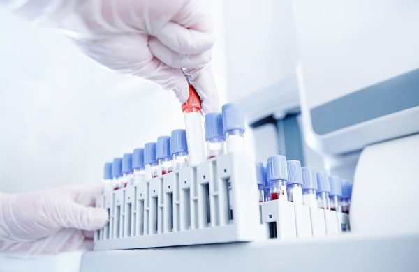 Company Info | Genex Diagnostics